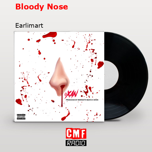La historia y el significado de la canción 'Bloody Nose - Earlimart